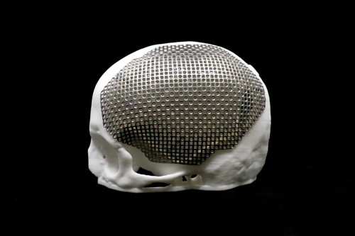 Neurosurgical Solutions