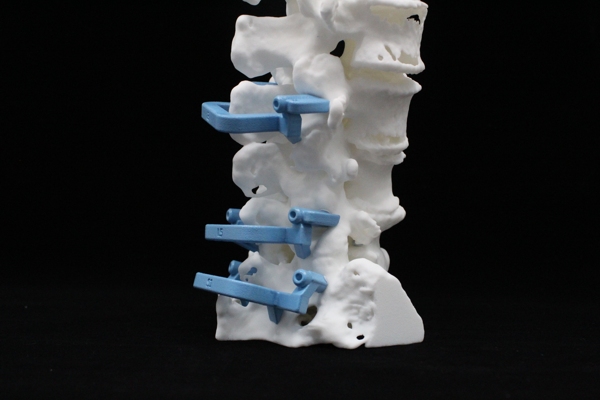 Spinal Applications