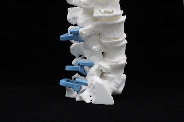 Spinal Applications