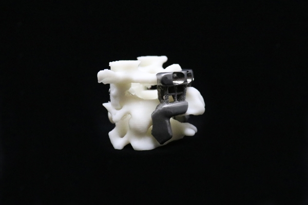 Spinal Applications